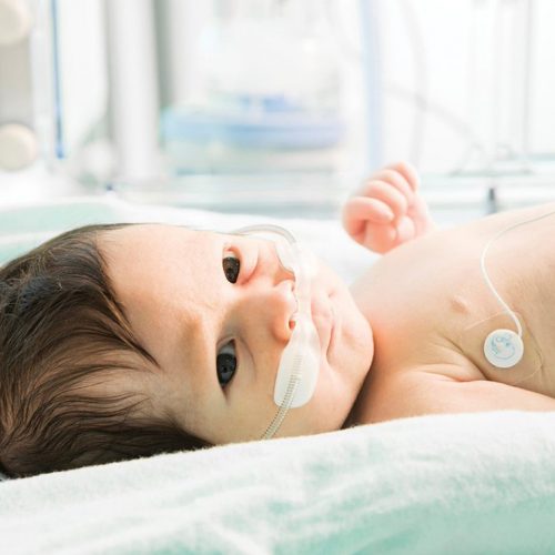Neonatal Ventilation – Respiratory Care Africa